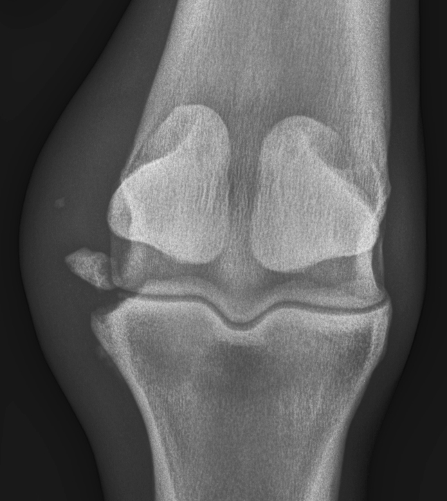 Mobile Radiography: X-Rays | B&W Equine Gro